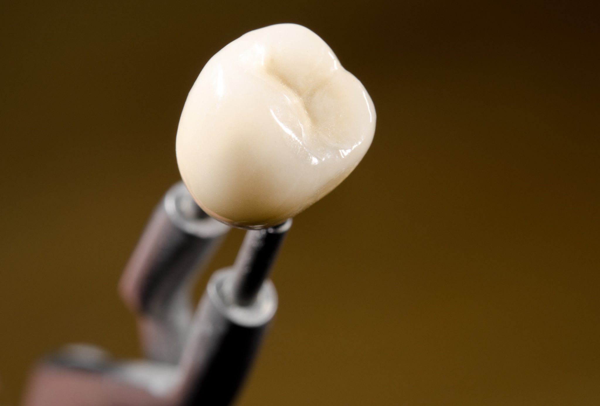 What Is the Best Material for Dental Crowns?